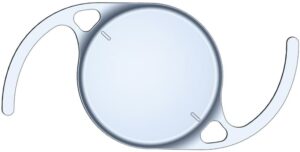 Biotech Lens- Types, Benefits, Cost & More